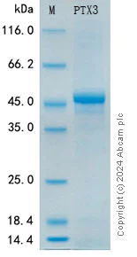 Recombinant Mouse PTX3 Protein Standard (His tag) (ab316541) | Abcam