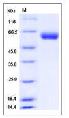 Phospholipase C Activity Assay Kit (Colorimetric) (ab273343) | Abcam