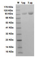 Recombinant Pyruvate phosphate dikinase protein (Active) (ab286038) | Abcam