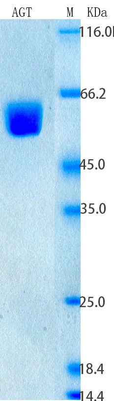 Recombinant Rat AGT Protein Standard (His tag) (ab316479) | Abcam