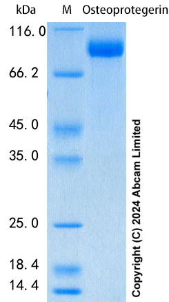 Recombinant Rat Osteoprotegerin Protein Standard (His tag) (ab316588 ...