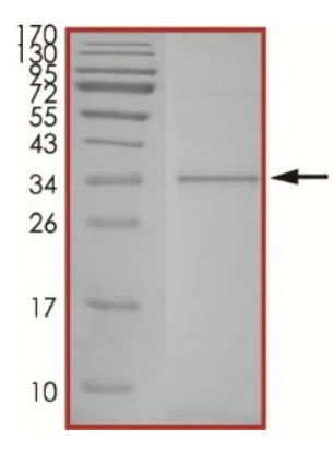 Recombinant SARS-CoV-2 Spike Glycoprotein RBD (mutated N439K) (ab283527 ...
