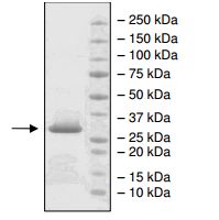 Recombinant Sortase A protein (His tag) (ab198443) | Abcam