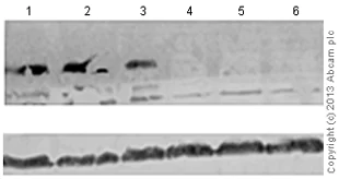 Anti-Ref2P antibody (ab178440) | Abcam