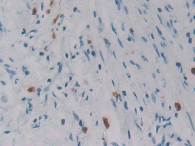 Anti-REG3G antibody (ab233480) | Abcam