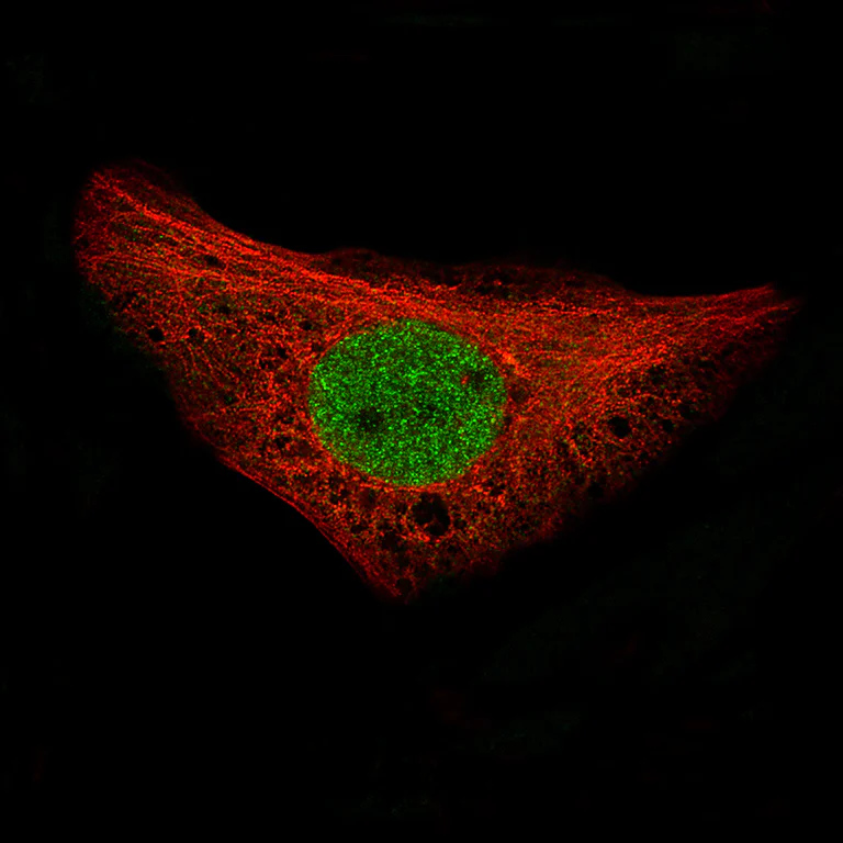 Anti-REST / NRSF antibody [CL0381] (ab211537) | Abcam