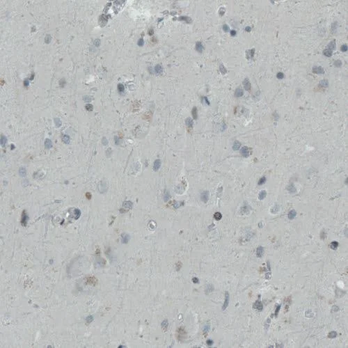 Anti-REST / NRSF antibody [CL0381] (ab211537) | Abcam