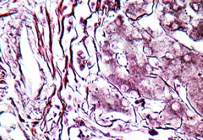 Reticulum Stain Kit (Connective Tissue Stain) (ab150684) | Abcam