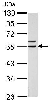 Anti-Retinoid X Receptor alpha/RXRA antibody (ab227273) | Abcam