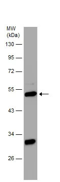 Anti-Retinoid X Receptor alpha/RXRA antibody (ab227273) | Abcam