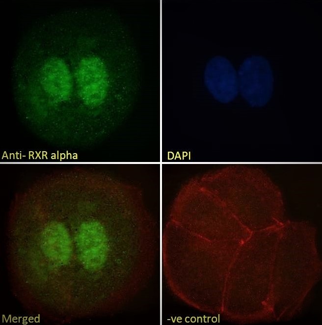 Anti-Retinoid X Receptor alpha/RXRA antibody (ab24363) | Abcam