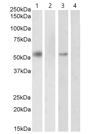 Anti-Retinoid X Receptor alpha/RXRA antibody (ab24363) | Abcam
