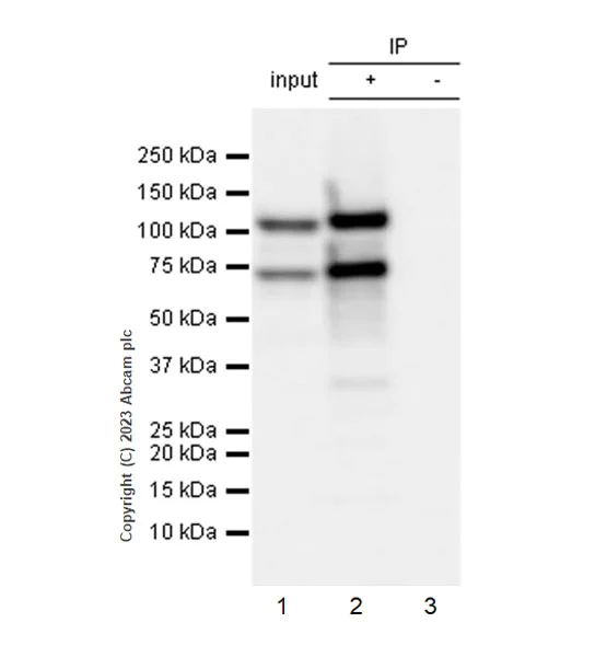 Anti-Rfx Cas13d (N-term) antibody [EPR23965-31] (ab314741) | Abcam
