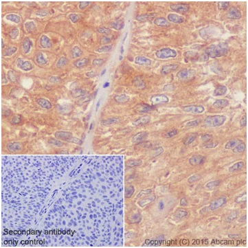 Anti-RhoA + RhoC antibody [EPR18133] (ab187026) | Abcam