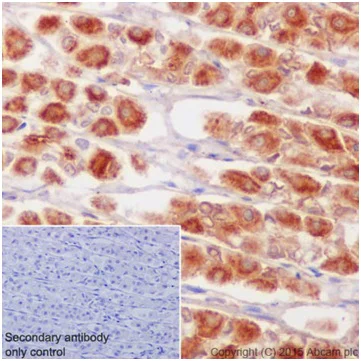 Anti-RhoA + RhoC antibody [EPR18133] (ab187026) | Abcam