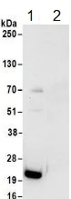Anti-Ribosomal protein S11/RPS11 antibody (ab157101) | Abcam