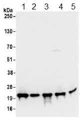 Anti-Ribosomal protein S11/RPS11 antibody (ab157101) | Abcam
