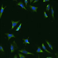 Anti-ribosomal RNA 抗体 [Y10B] (ab171119) | Abcam