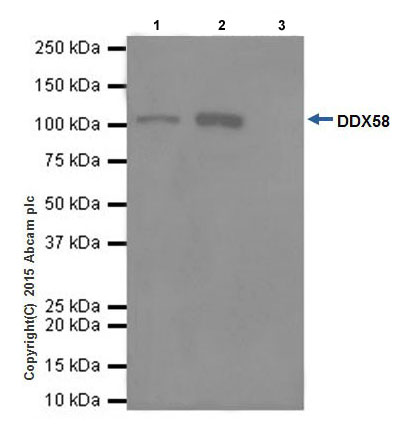 Anti-RIG-I/DDX58 antibody [EPR18629] (ab180675) | Abcam
