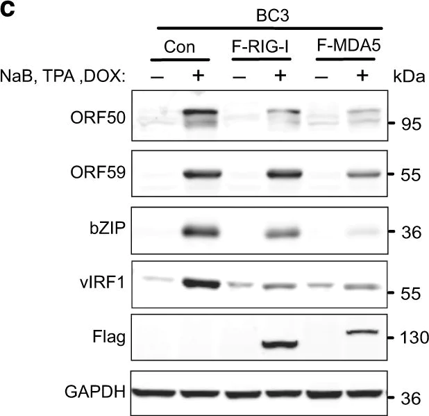 Anti-RIG-I/DDX58 antibody [EPR18629] (ab180675) | Abcam