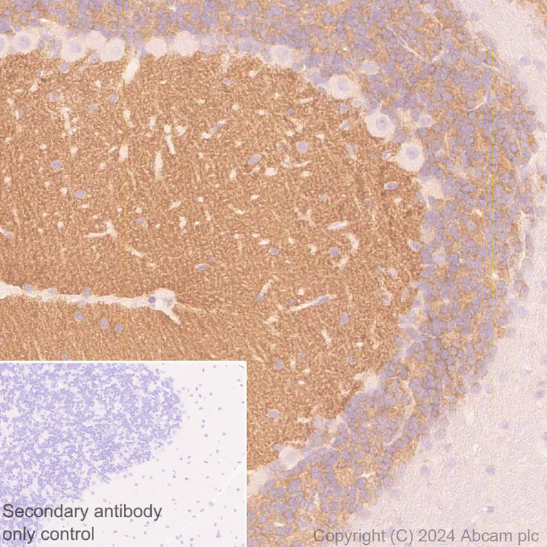 Anti-RIM1 antibody [EPR29131-30] (ab317450) | Abcam