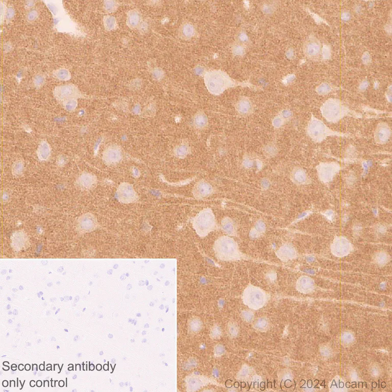 Anti-RIM1 antibody [EPR29131-30] (ab317450) | Abcam