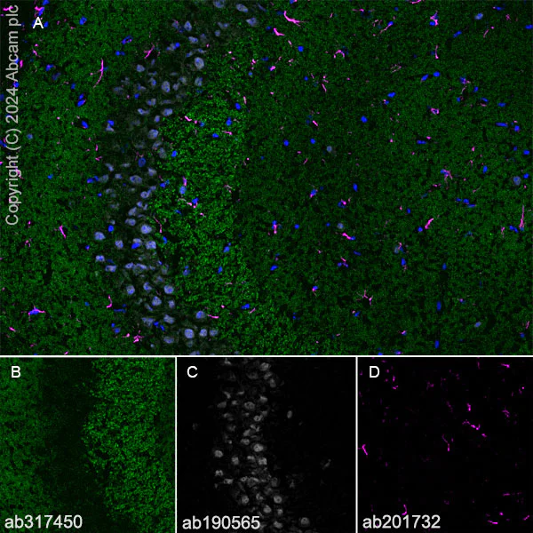 Anti-RIM1 antibody [EPR29131-30] (ab317450) | Abcam