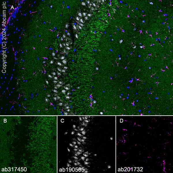 Anti-RIM1 antibody [EPR29131-30] (ab317450) | Abcam