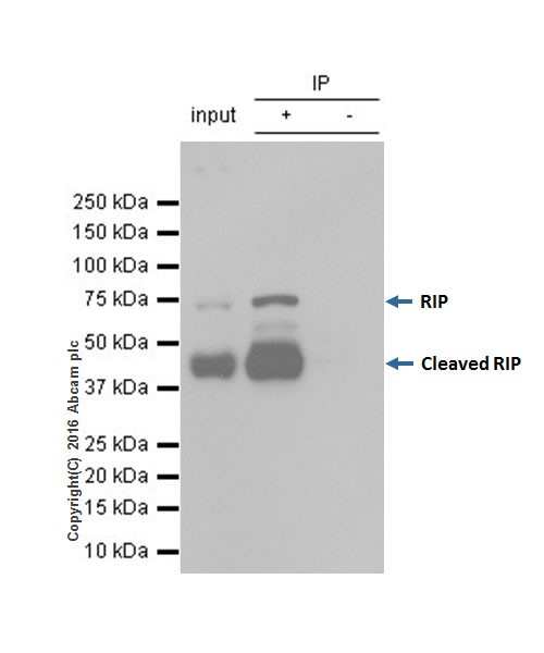 Anti-RIP antibody [EPR19697] (ab202985) | Abcam