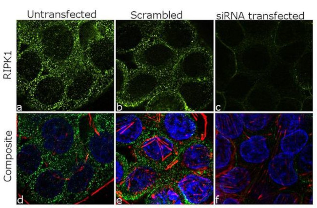 Anti-RIP Antibody [RP23040227] (ab313489) | Abcam