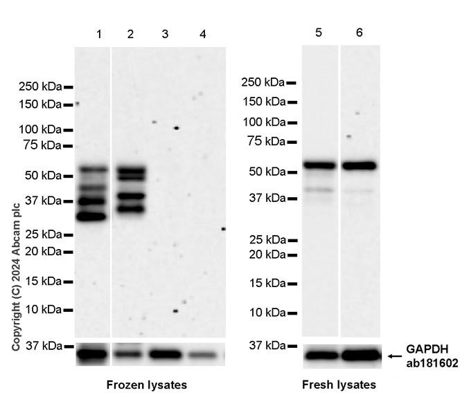 Anti-RIP3 antibody [EPR24374-9] (ab316957) | Abcam