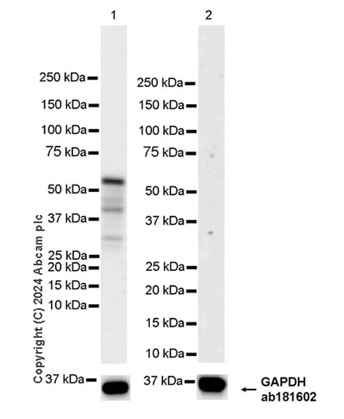 Anti-RIP3 antibody [EPR24374-9] (ab316957) | Abcam