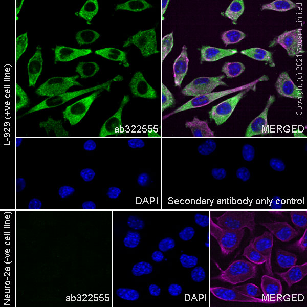 Anti-RIP3 antibody [EPR26080-567] (ab322555) | Abcam