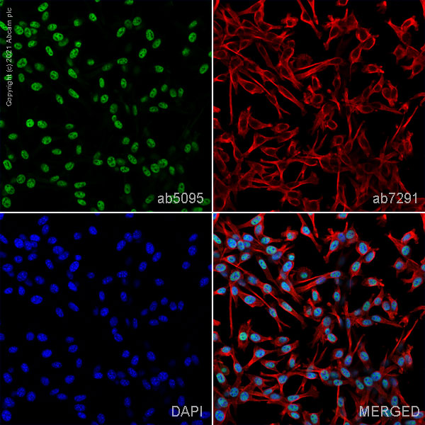 RNA pol II CTD repeat YSPTSPS (phospho S2) antibody (ab5095) | Abcam