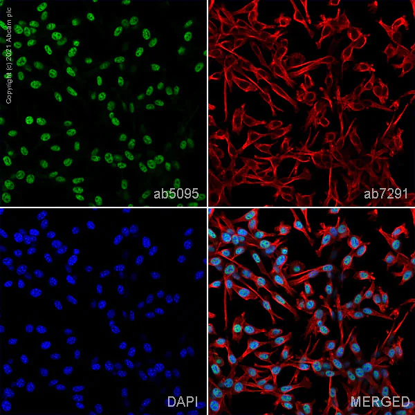 RNA pol II CTD repeat YSPTSPS (phospho S2) antibody (ab5095) | Abcam