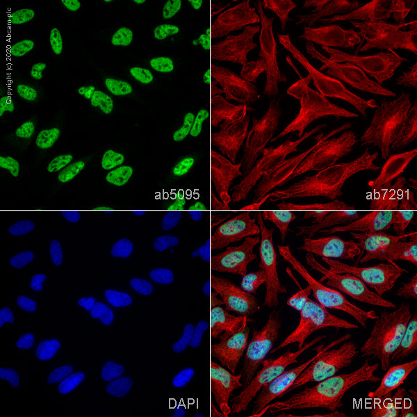 RNA pol II CTD repeat YSPTSPS (phospho S2) antibody (ab5095) | Abcam