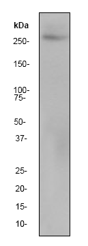 Anti-RNA polymerase II RPB1 antibody [EPR1509Y] (ab76123) | Abcam