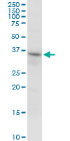 Anti-RNF144A antibody (ab89260) | Abcam