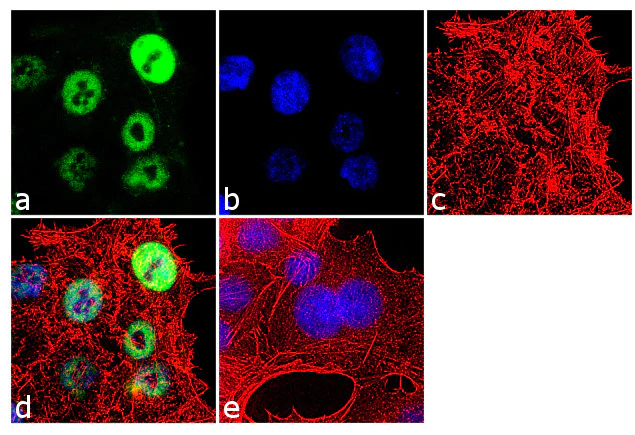 Anti-RNF20 antibody [RP23040124] (ab313445) | Abcam