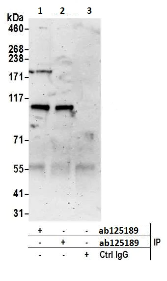 Anti-RNF31/HOIP antibody KO Tested (ab125189) | Abcam
