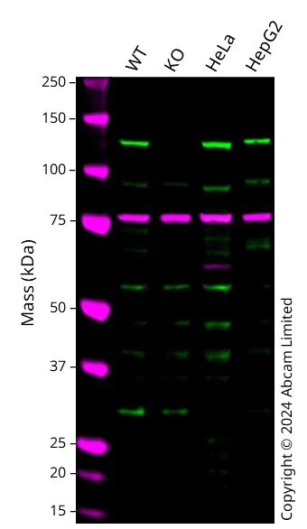 Anti-RNF31/HOIP antibody KO Tested (ab125189) | Abcam
