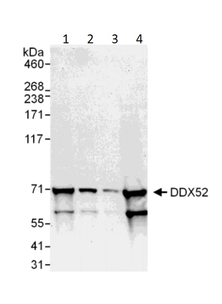 Anti-ROK1 antibody (ab225708) | Abcam