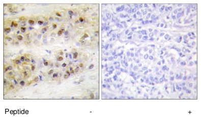 Anti-ROR alpha/RORA antibody (ab70061) | Abcam