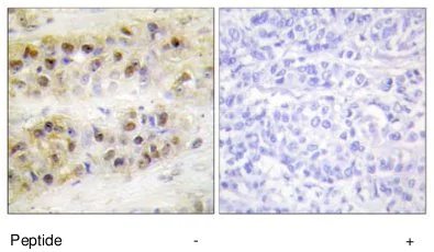 ROR alpha/RORA抗体 (ab70061)| Abcam中文官网