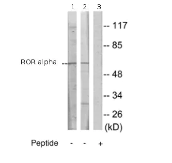 Anti-ROR alpha/RORA antibody (ab70061) | Abcam