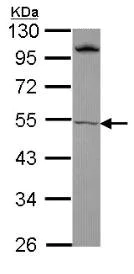 Anti-ROR beta/RORB antibody (ab154889) | Abcam