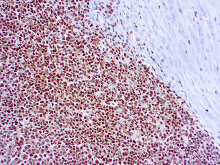 Anti-RPA32/RPA2 antibody [9H8] - mouse monoclonal (ab2175) | Abcam