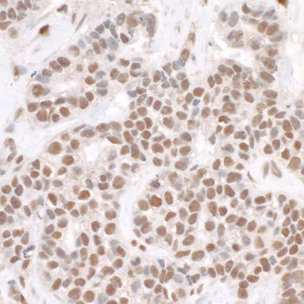 Anti-RPA32/RPA2 antibody (ab10359) | Abcam