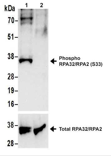 RPA32/RPA2(磷酸化S33)抗体 (ab211877)| Abcam中文官网