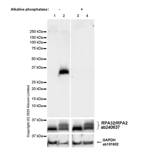 Anti-RPA32/RPA2 (phospho S4) antibody [EPR29611-59] - BSA and Azide ...